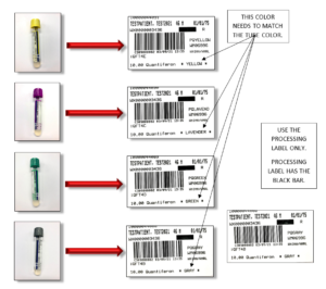 Updated TB Testing by QFT-Plus - Warde Medical Laboratory